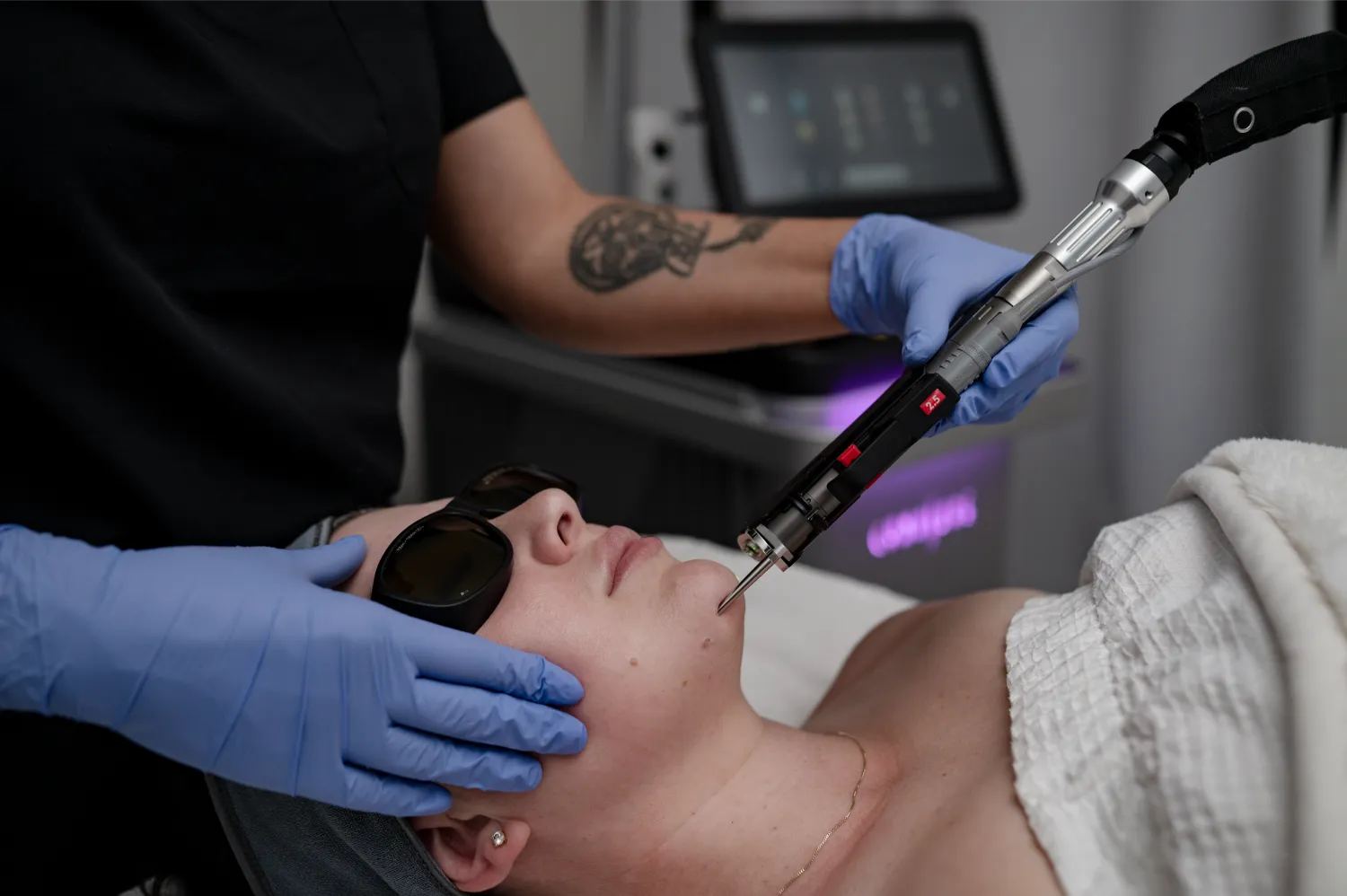 Laser Skin Rejuvenation in Ruston, WA: Smooth & Radiant Skin